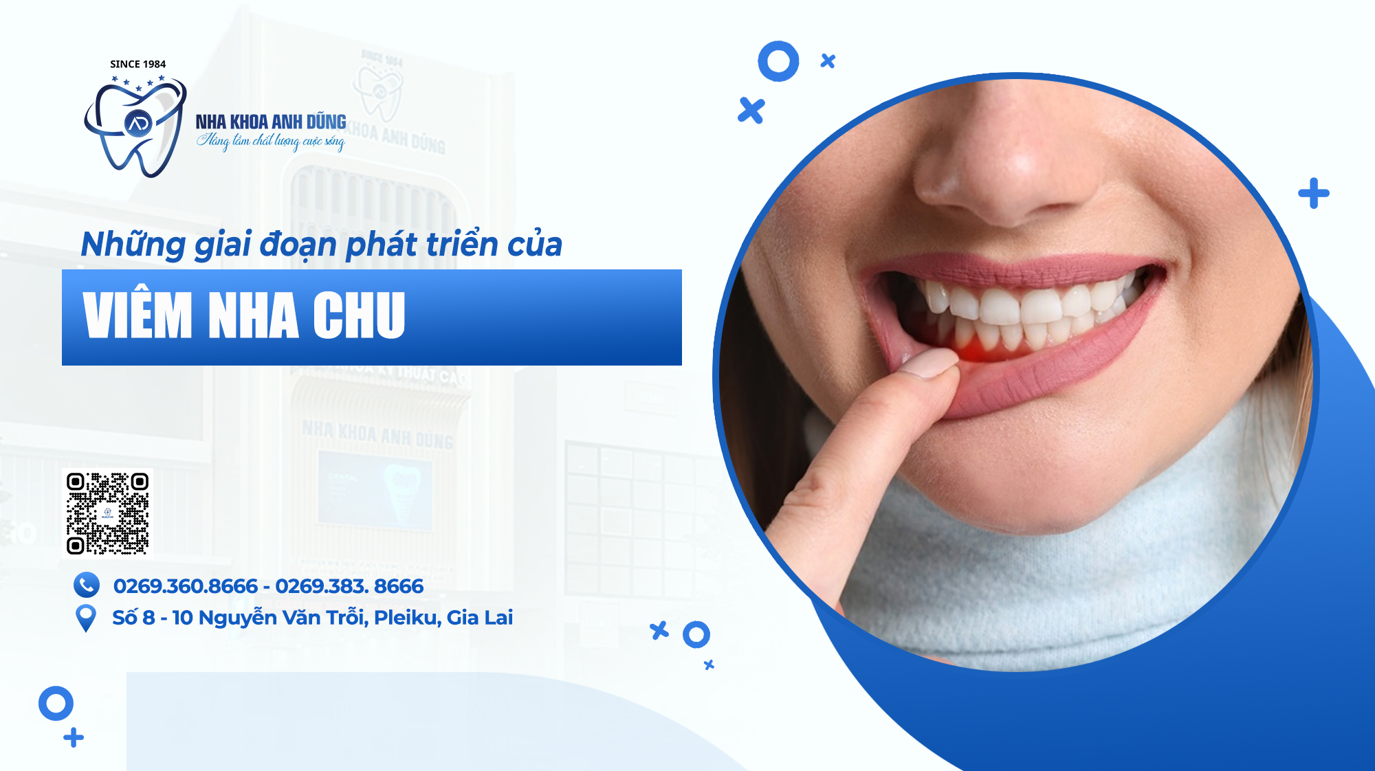 NHỮNG GIAI ĐOẠN PHÁT TRIỂN CỦA BỆNH VIÊM NHA CHU